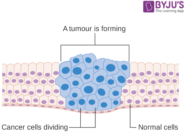 Carcinogenic Substances- Harmful Effects | Cancer Causes | BYJU'S