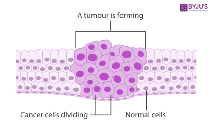 Carcinogenic Substances- Harmful Effects | Cancer Causes | BYJU'S
