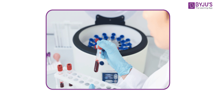 Centrifugation - Centrifuge Definition, Centrifuge Machine, Examples