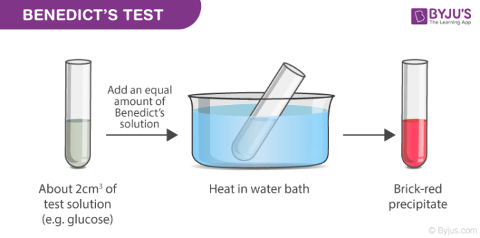 Benedict’s Test - Reagent Preparation, Principle, Procedure, Reaction